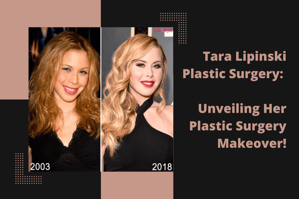 Tara Lipinski ပလပ်စတစ်ဆာဂျရီ-သူမ၏ပလပ်စတစ်ခွဲစိတ်ပြုပြင်ဖန်တီးမှုထုတ်ဖော်ပြသ။
